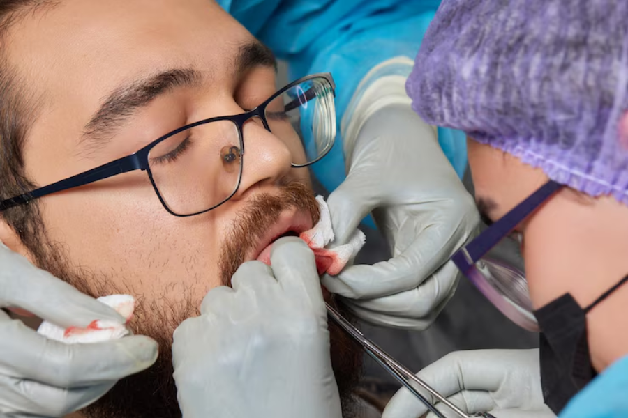 Managing Tooth Extraction Bleeding: Effective Strategies for Quick Recovery