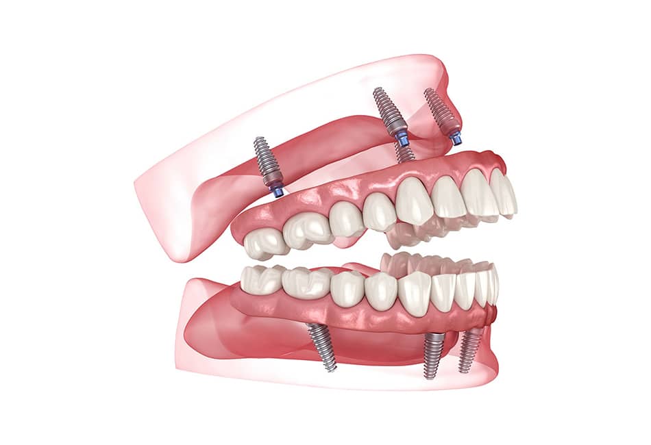 Our Cost - Denville Dental Group