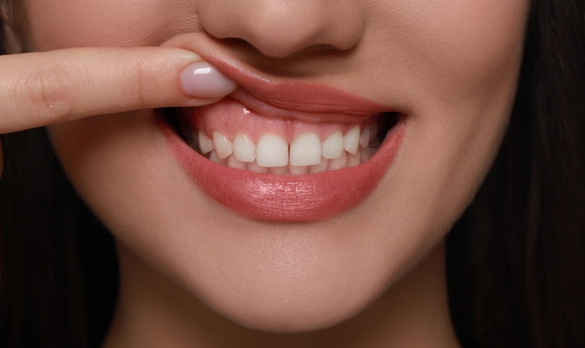 Gum Contouring: Can You Contour Your Way With Braces On?